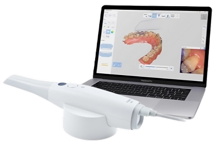 Check-up digitale - Studio Dentistico - Dr. Oberti